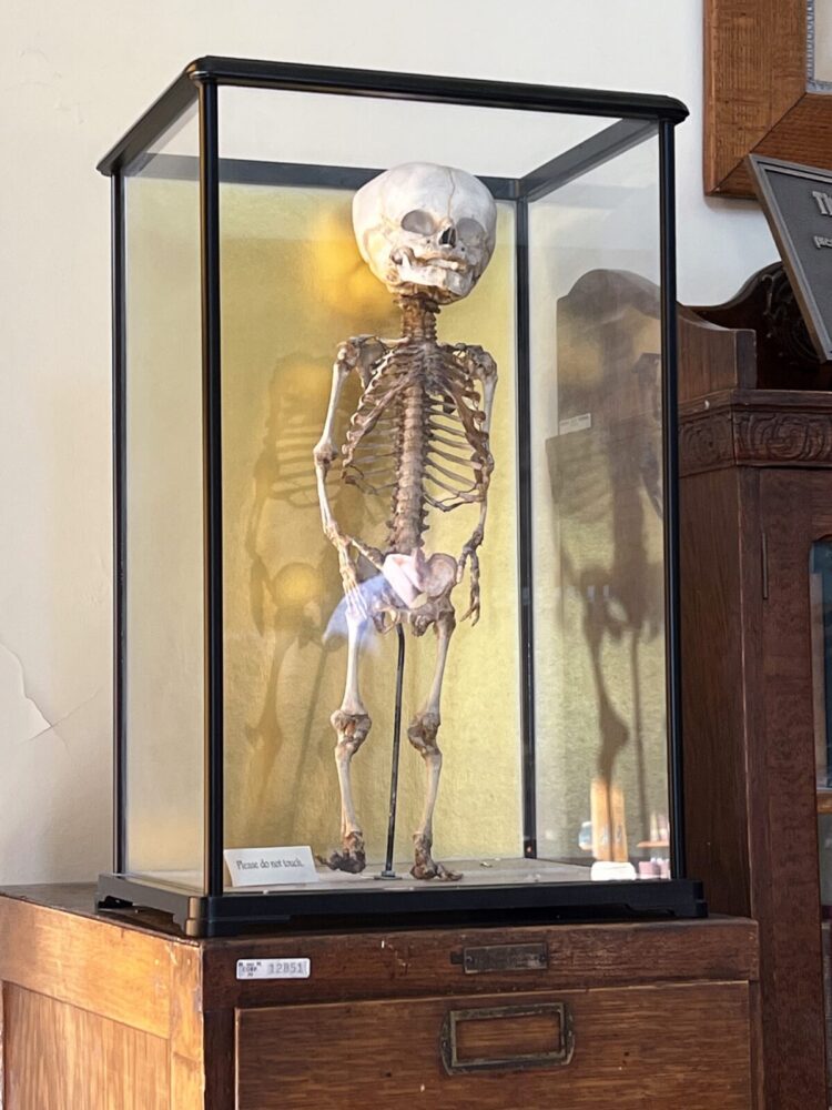 Visiting: Indiana Medical History Museum - Stuck at the Airport